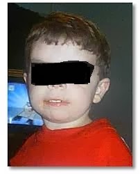 Medical Treatment Pictures-for Better Understanding: What is Aarskog ...