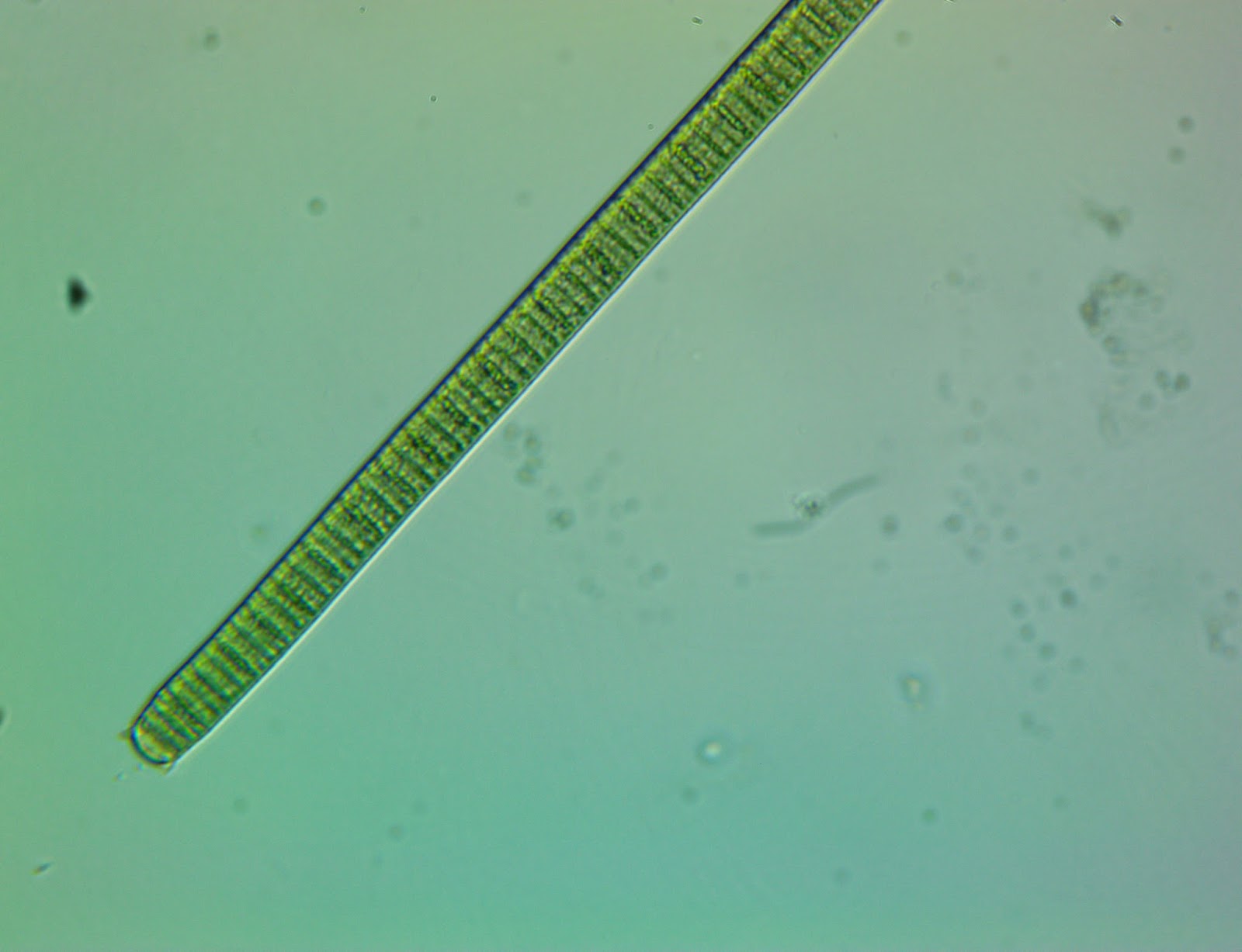 Wildlife Monitor: Cyanobacteria activity detected under ice in Bantam Lake