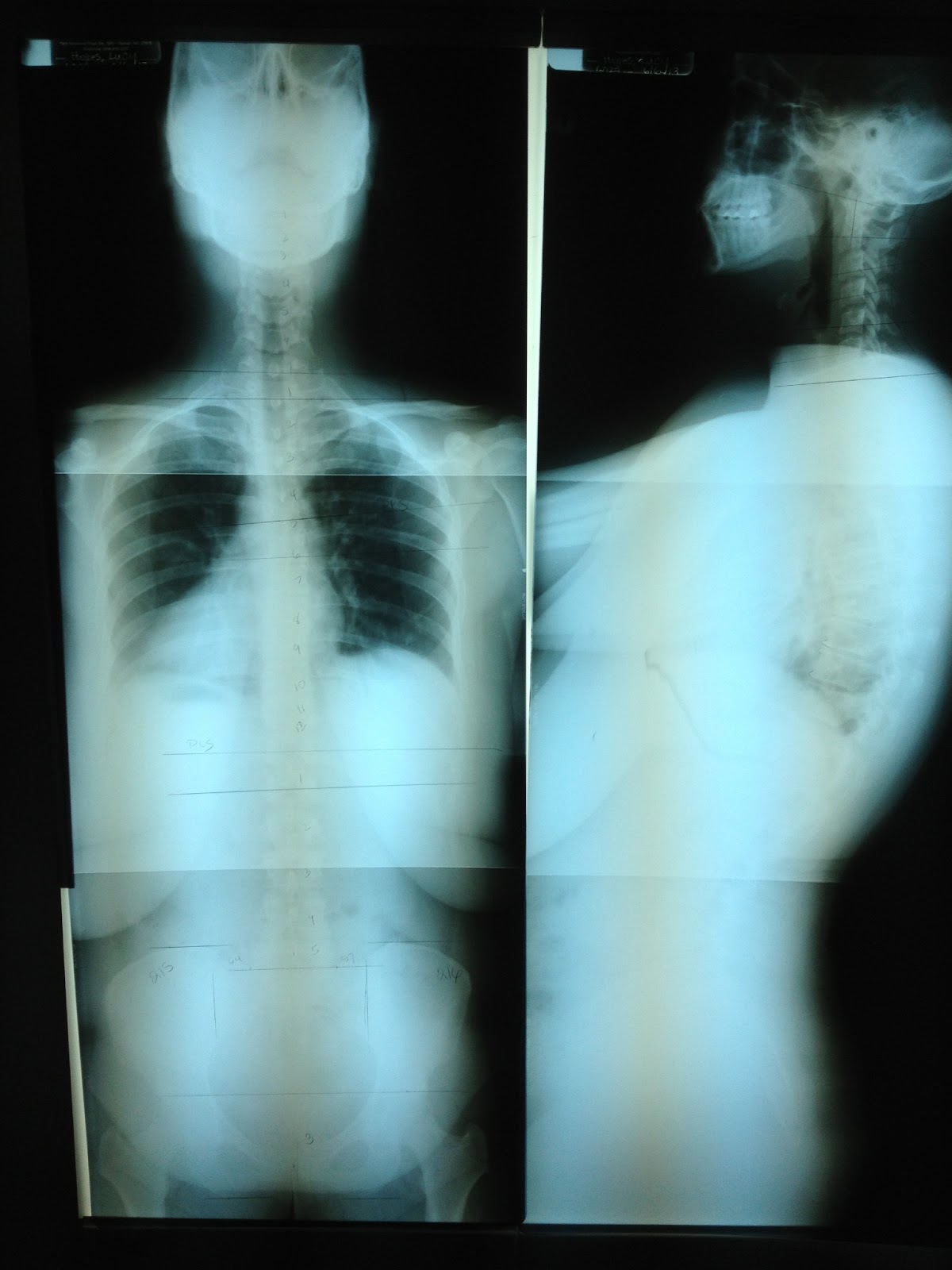 Lucy Is Losing It: Procrastination, Excuses, Poop, and X-rays