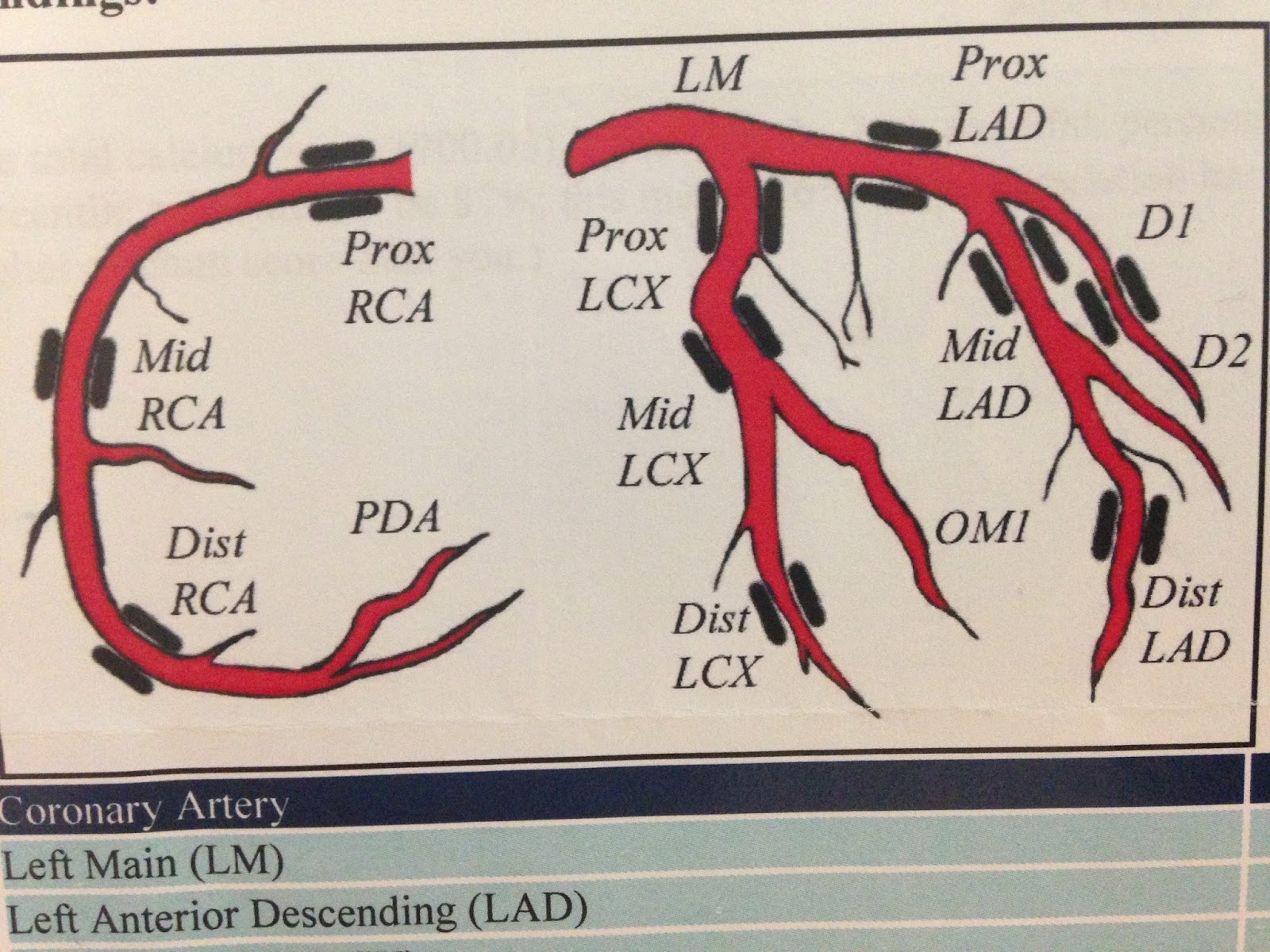 Calcium Ct Score Chart