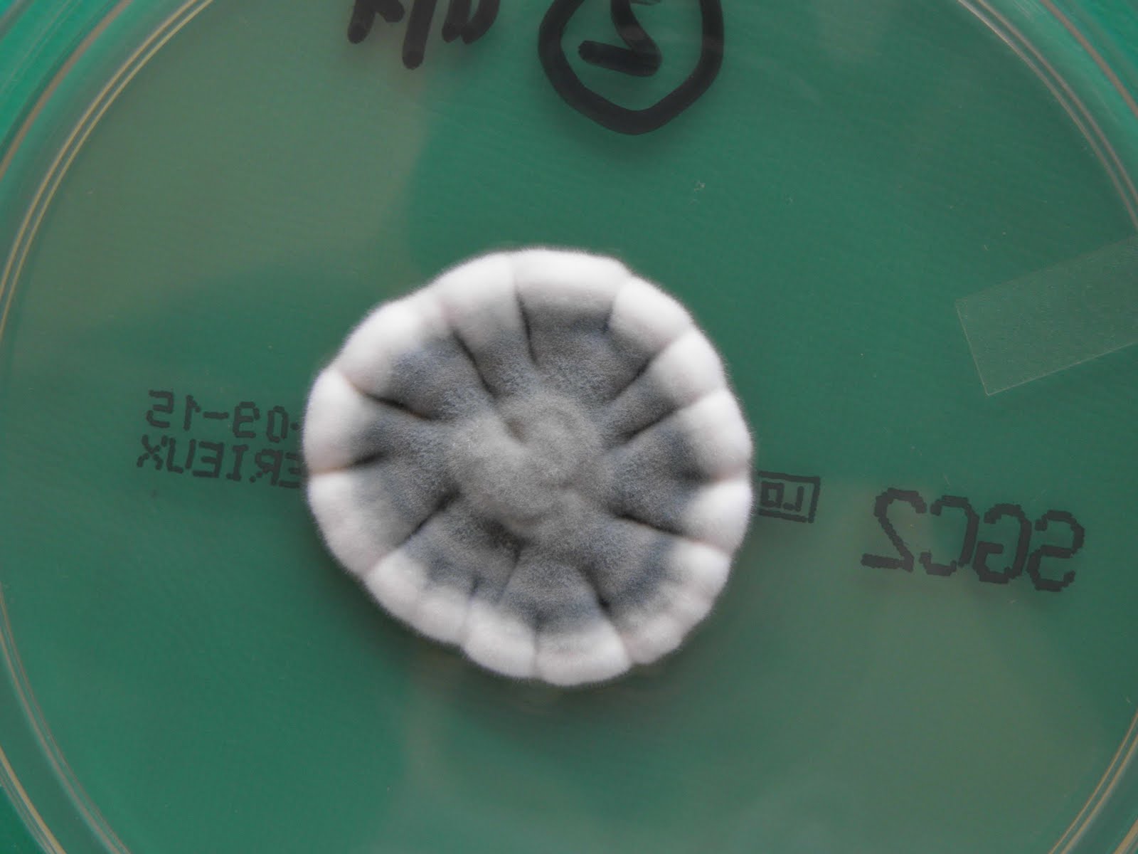 ATLAS MICOLOGIA: ASPERGILLUS VERSICOLOR