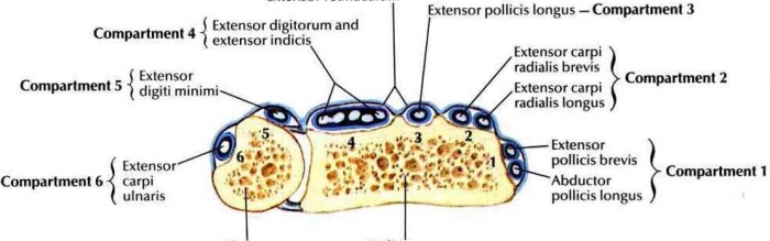 MRI Musculo-Skeletal Section: Tendon intersection syndrome at forearm.