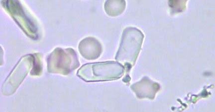 Veterinary Clinical Pathology: Feline urine sediment