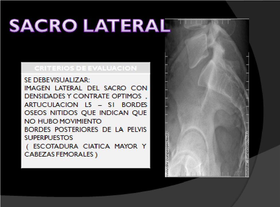 Criterios De calidad Y Evaluación De Las Imágenes radiograficas ...