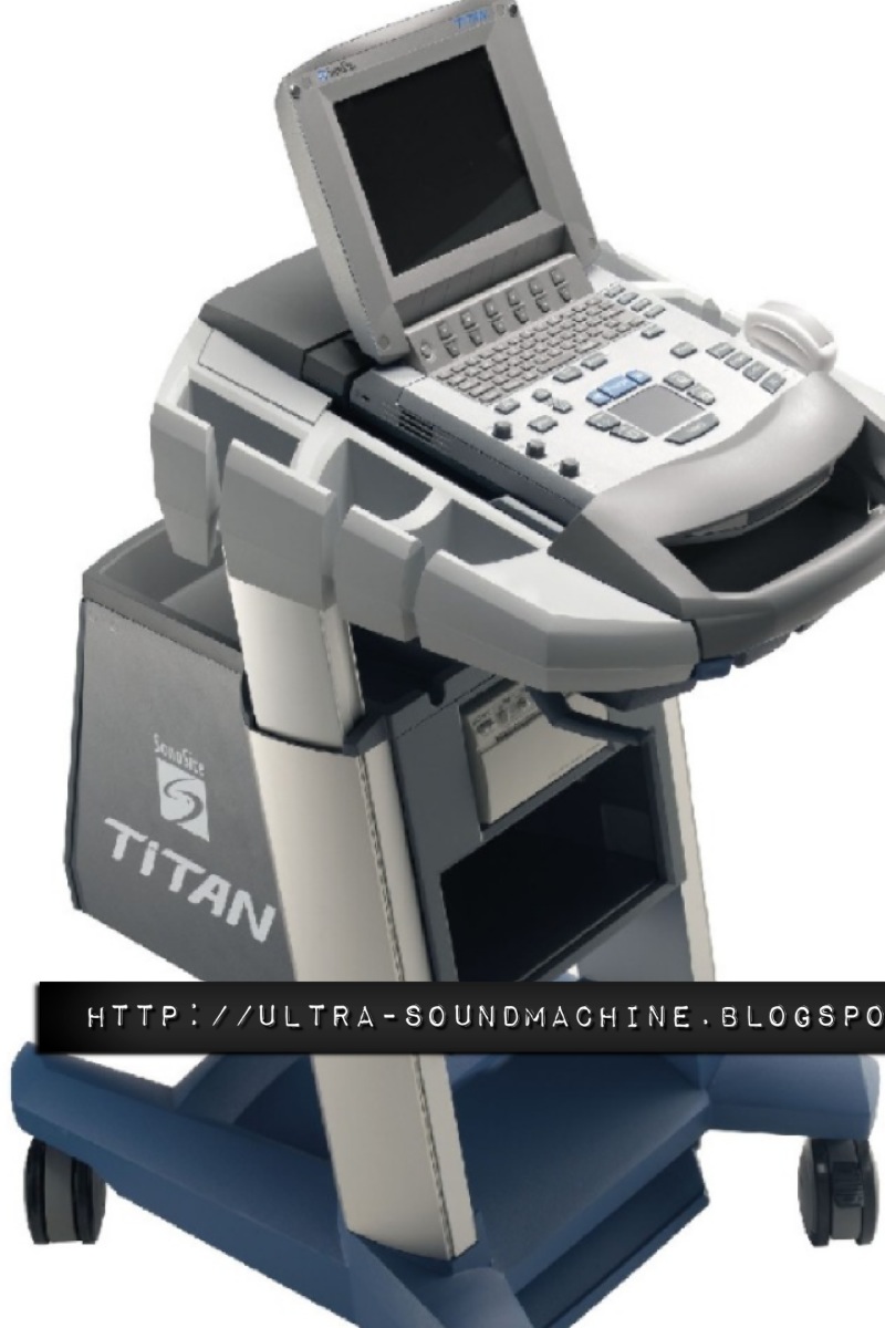 Ultra Sound Machine: Sonosite Titan Ultrasound Machine