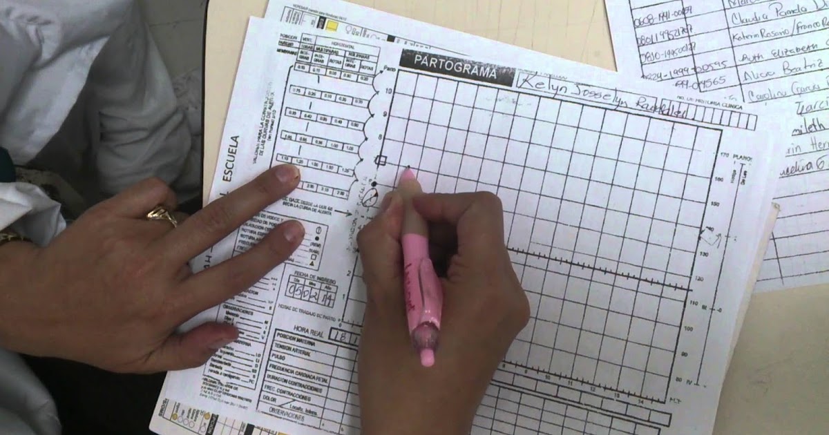 MATERNIDAD SEGURA: PARTOGRAMA