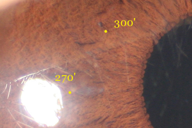 Modern & Multidimensional Iridology: Classical, Modern ...