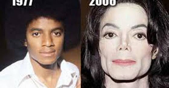 Michael Jackson Plastic Surgery Before and After Nose Jobs and Skin ...