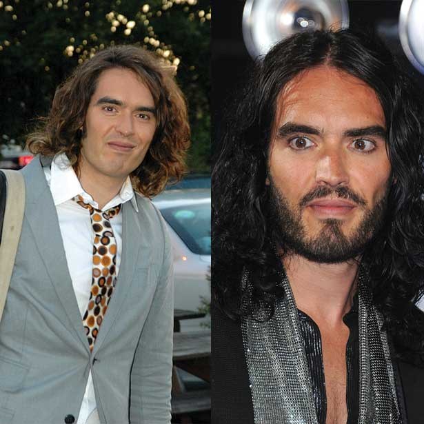 Russell Brand Plastic Surgery