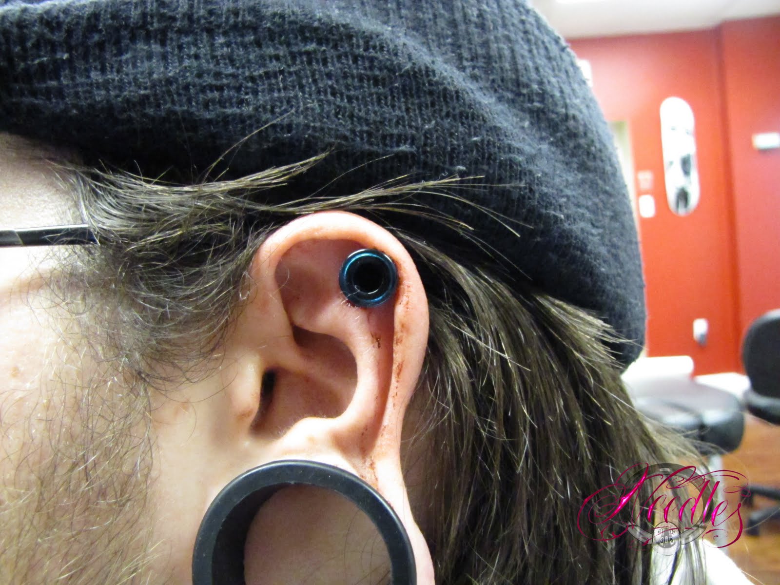 NINE BODY PIERCING BLOG: Fresh Dermal Punch on Flat's!!!