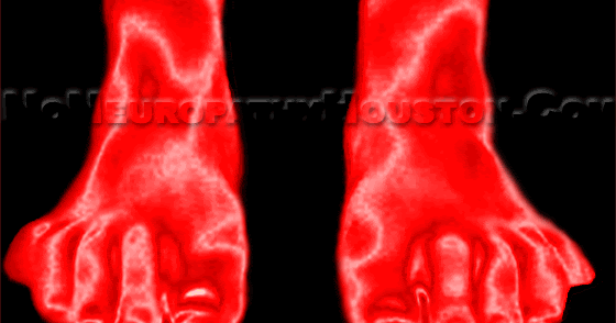 Life Changing Health News: Peripheral Neuropathy Kills Your Nerves!