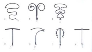 Catatan Risca...: Alat Kontrasepsi Dalam Rahim (AKDR)/IUD