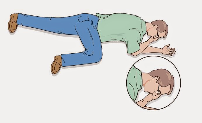 Recovery Position Reassess ABCs frequently ~ Nursing
