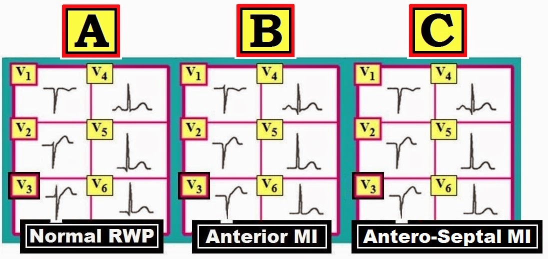 Lead groupings : 네이버 블로그