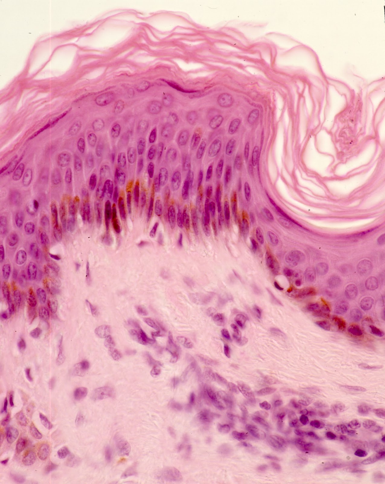 Histología Básica y Sistémica: Epitelios