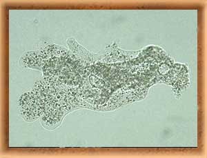 Amoeba Under Microscope Labelled