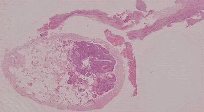 Oral Pathology India: 2015