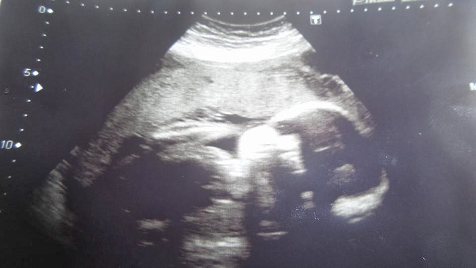 28 weeks pregnant - scan! | Coming from Carson's Mummy