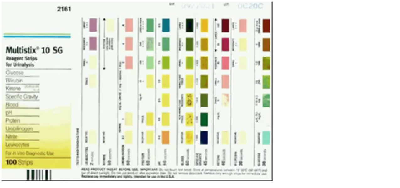 BERBAGI INFO TEKNOLOGI ALAT KESEHATAN: URINE ANALYZER