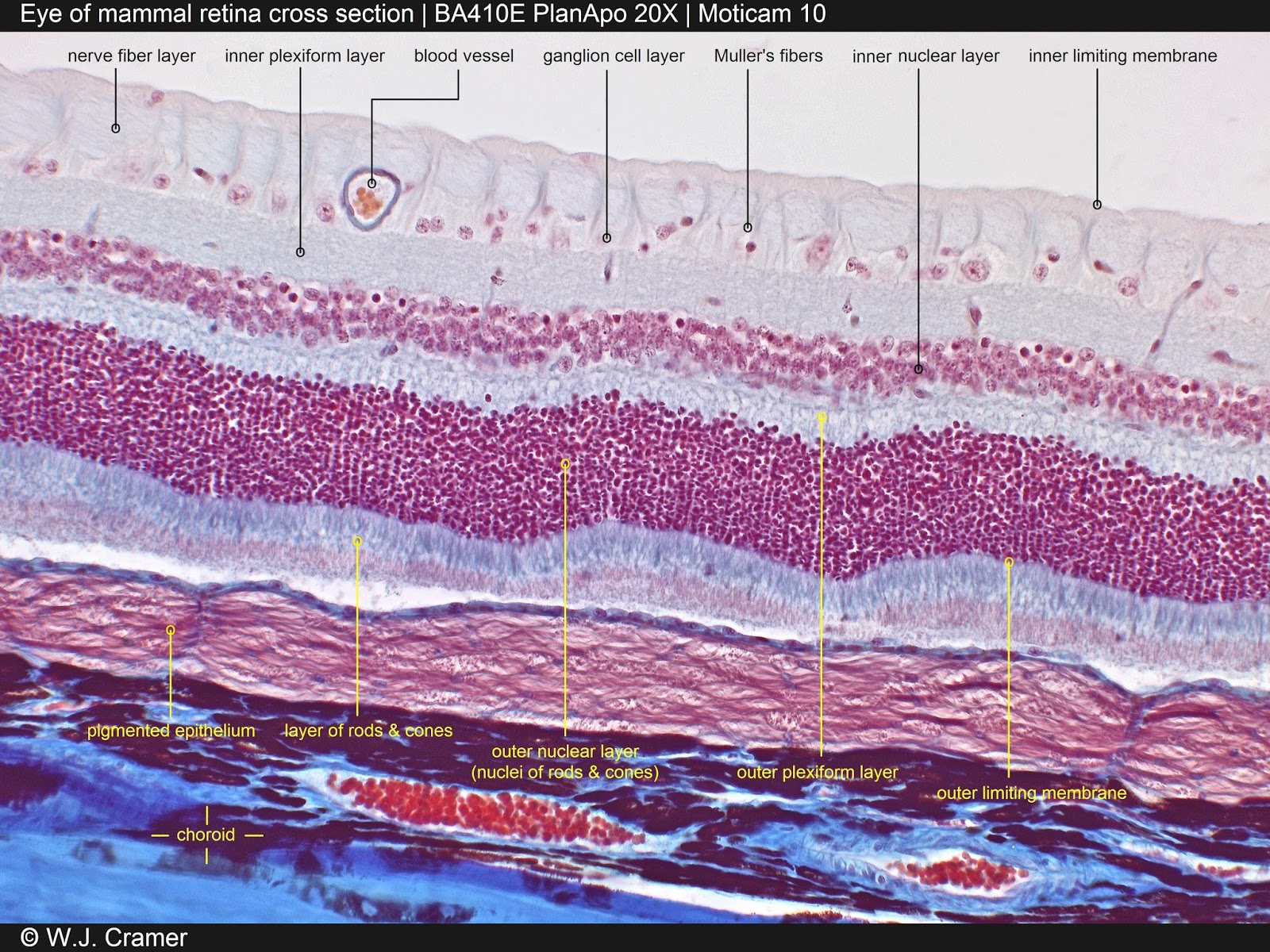 Motic Europe | Blog: The retina, a bio-chip on the back of the eye