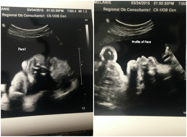 Life with the Obies: Pregnancy Update: 31 Weeks