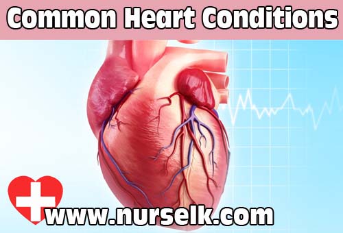 Common Heart Conditions | Nurselk.com