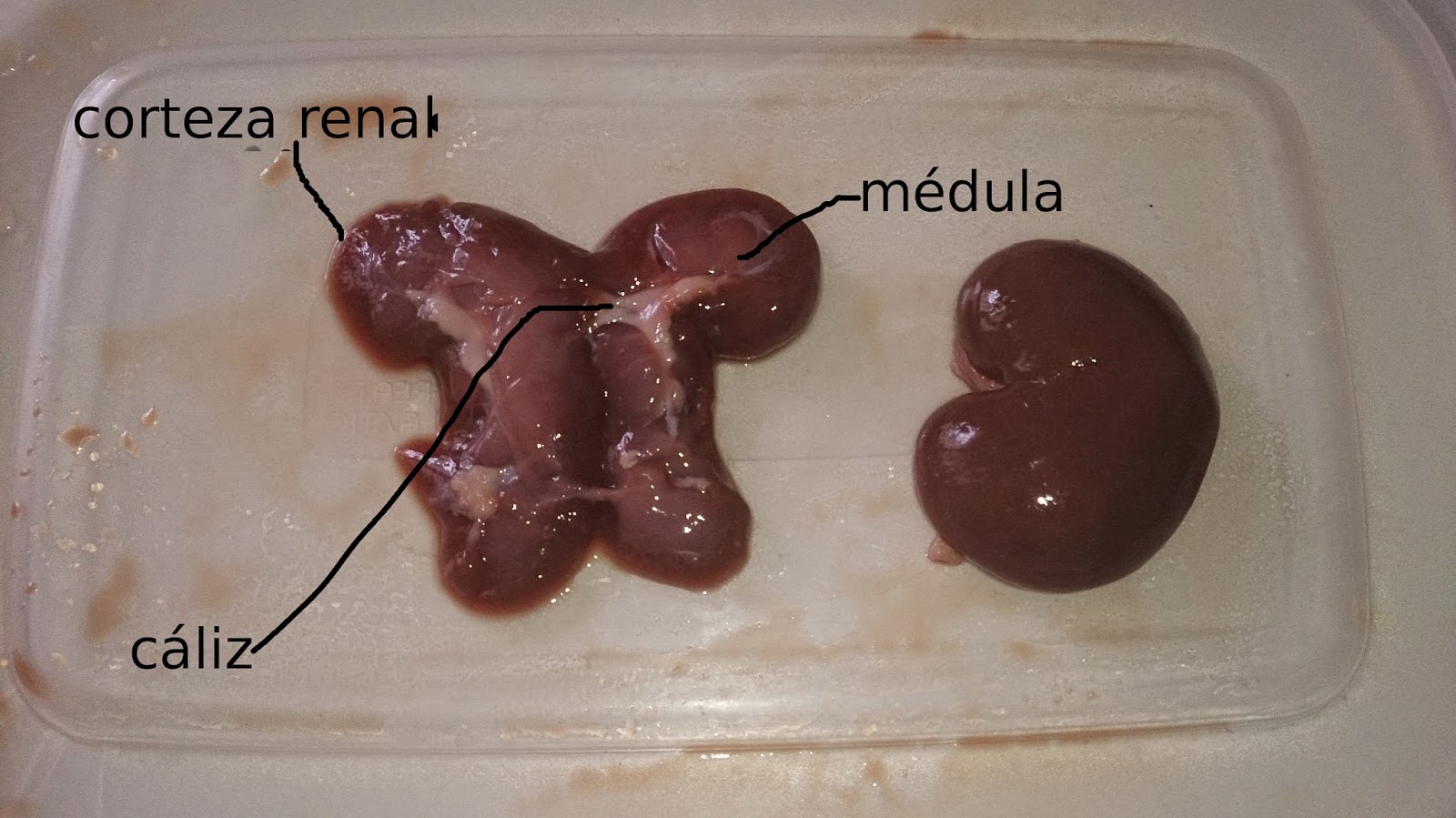 Segundeando : DISECCIÓN DE RIÑÓN
