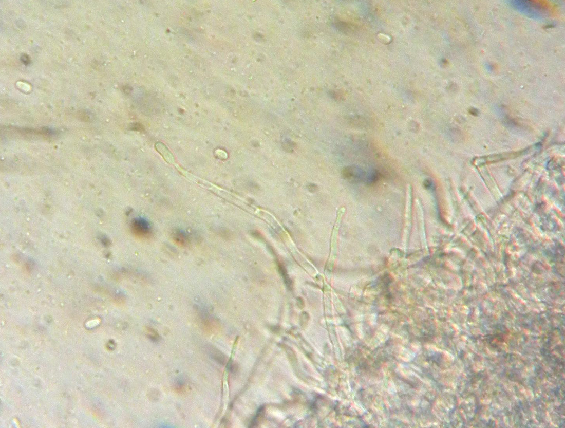 Weird and Wonderful Wild Mushrooms: Choosing Between Sex and Celibacy ...