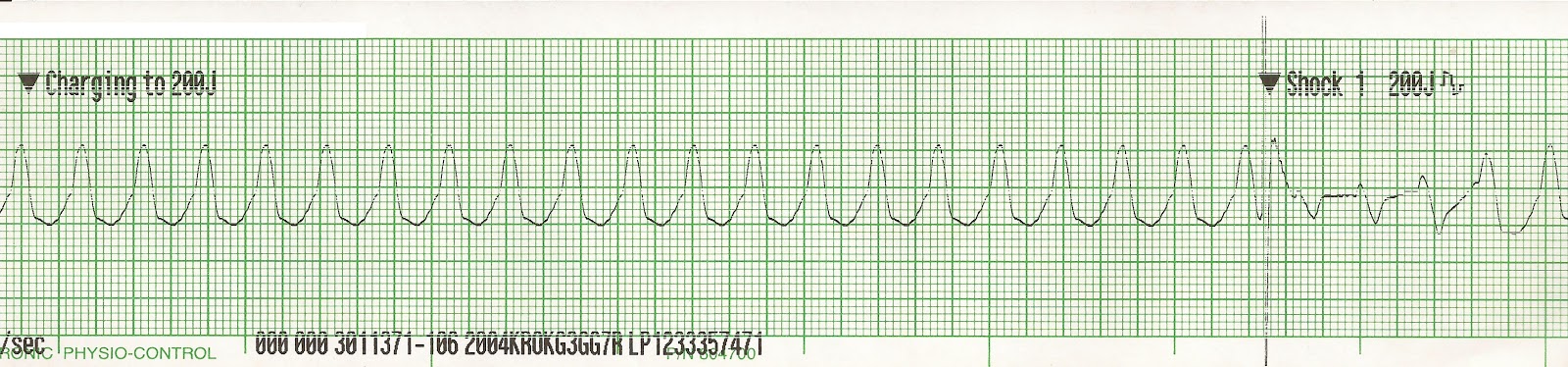 Float Nurse: Pulseless VF/VT