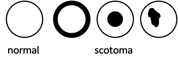 yuan's !nk: PART 2 brain varcularisation and ventricular system ...