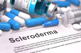 Michael Simons, Yale | Blogspot: The Causes and Symptoms of Scleroderma
