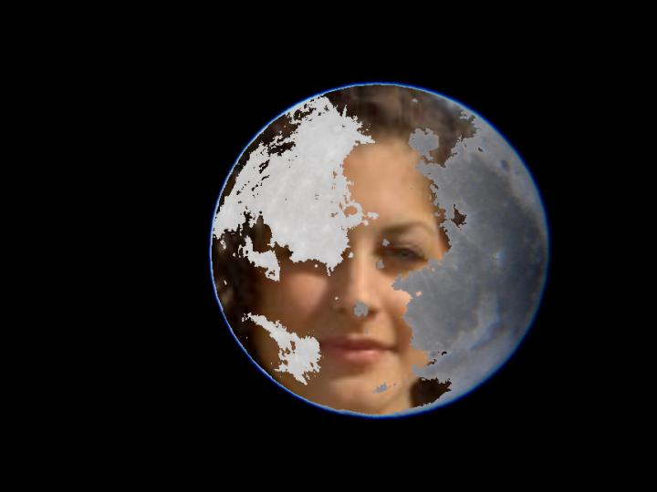 Broken Radius: 02/2013 - 03/2013