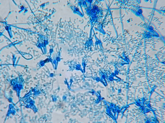 Fun With Microbiology (What's Buggin' You?): Paecilomyces lilacinus