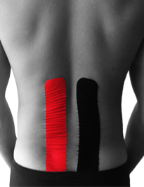 ARES Kinesiology Tape: Arestape Applications - Lower Back 3