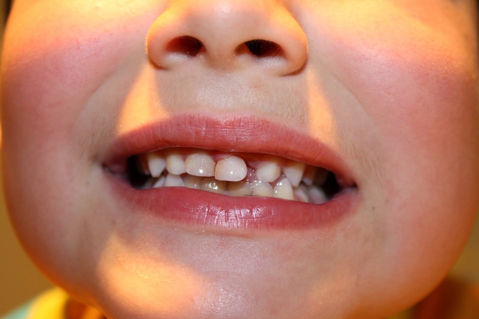 Ryleigh's and Layden's story is the best that is ever told.: Australian ...