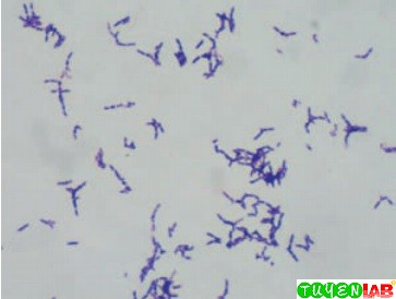 [Microbiology] Atlas of Aerobic Gram-Positive Bacilli | Free Medical Atlas