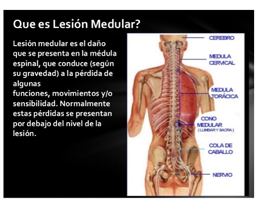 Lesiones Medulares