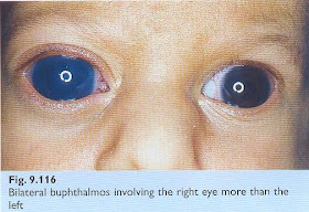 DOCZONE: INTERESTING OPHTHALMOLOGY CLINICAL PHOTOGRAPHS