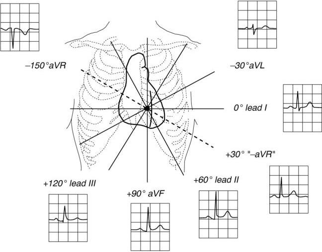 松下 ER ランチ・カンファレンス: キャブレラ配列 Cabrera sequence