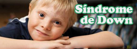 Sindrome de DOWNS