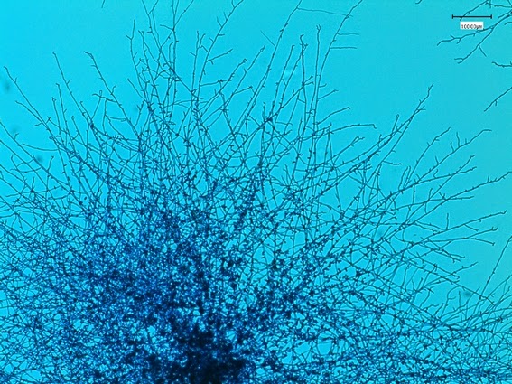 Fun With Microbiology (What's Buggin' You?): Ochroconis species