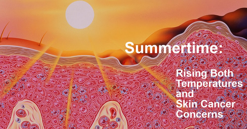 Summertime: Rising Both Temperatures and Skin Cancer Concerns