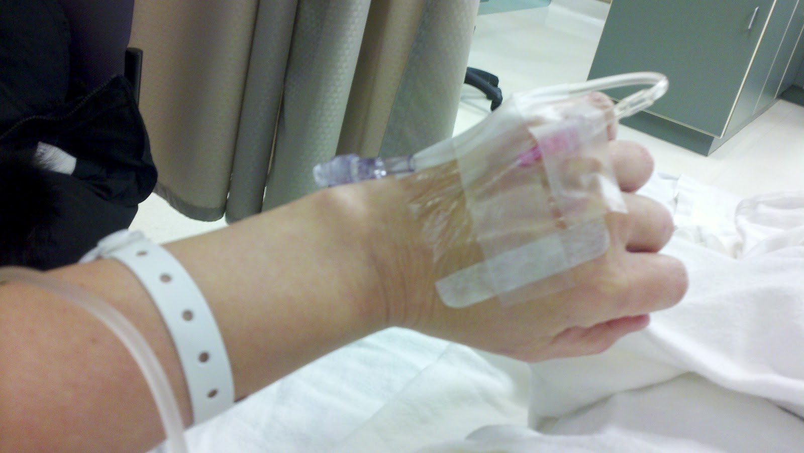 All About Morton's Neuroma: Surgery & Recovery