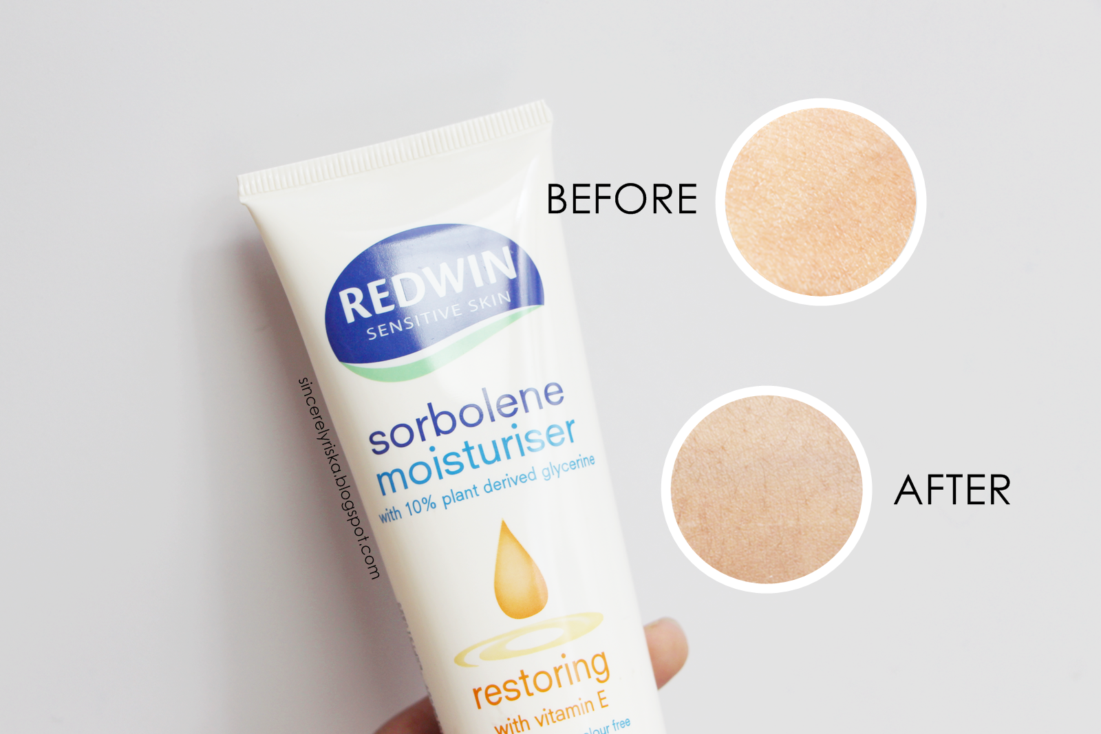 Sincerely, Riska.: Redwin Sorbolene Moisturiser w/ Vitamin E, Kulit ...