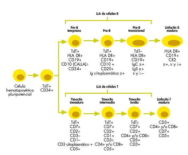 Leucemia Linfoide Aguda (LLA)