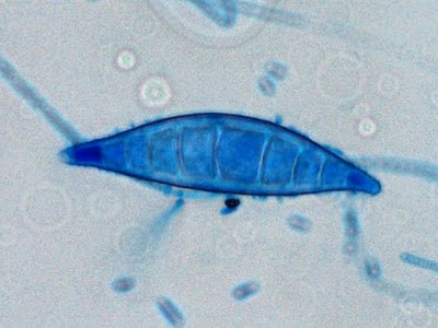 Fun With Microbiology (What's Buggin' You?): Microsporum canis