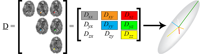 The diffusion tensor, and its relation to FA, MD, AD and RD | Diffusion ...