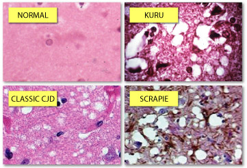 Bovine Spongiform Encephalopathy (Penyakit Sapi Gila) ~ Veterinary One
