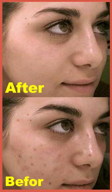 Tips on rejuvenating skin with Baking Soda