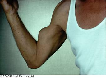 The Grimm Details: I think I have a Muscle Strain. What should I do?